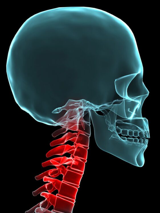 Bone Proteins in the Neck | National Spine Health Foundation