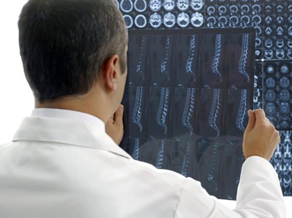 Microdiscectomy | National Spine Health Foundation