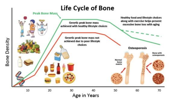 Lifelong Nutrition for Healthy Bones | National Spine Health Foundation