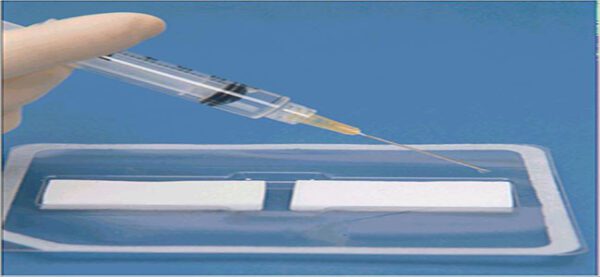 Bone Proteins in the Lower Back | National Spine Health Foundation