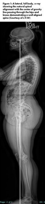 Taking Care of Your Neck: The Importance of Motion and Alignment ...