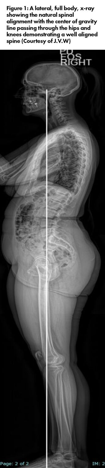 Taking Care of Your Neck: The Importance of Motion and Alignment ...