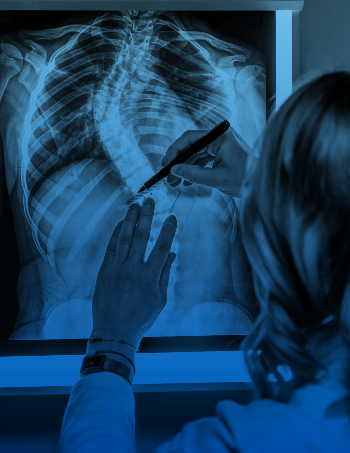 Adult Spinal Deformity Conditions Impact Overall Health | National ...