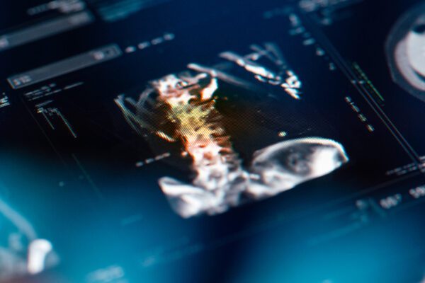 Spine Anatomy | Healthy Spine Tips | Expert Advice