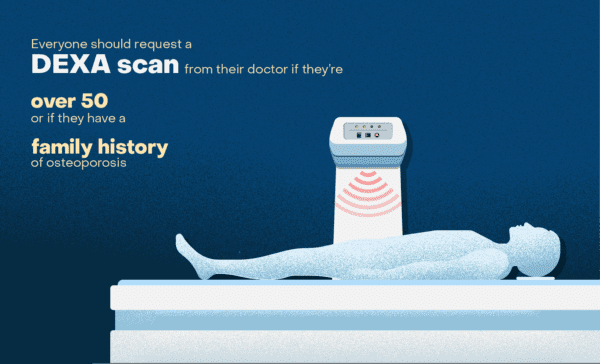 Bone Health Assessment | National Spine Health Foundation