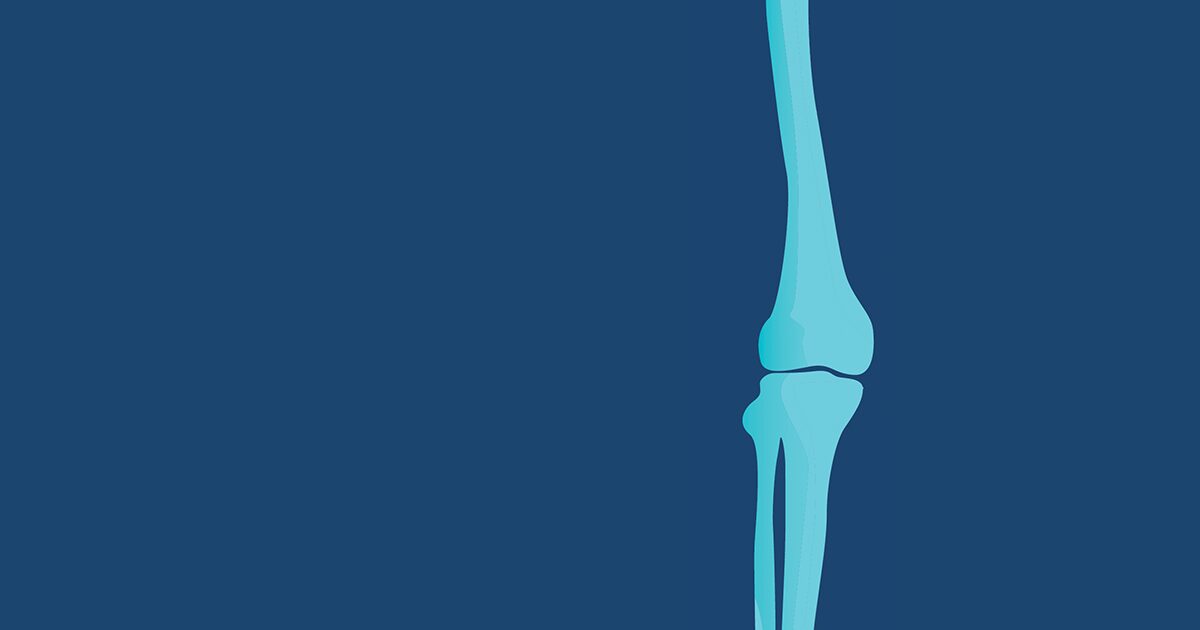 Bone Health Basics: Our Amazing Bones | National Spine Health Foundation