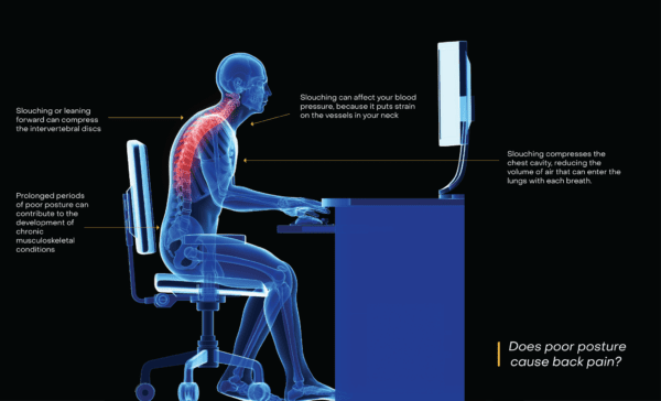 Spine Health: Posture and Workplace Ergonomics | National Spine Health ...