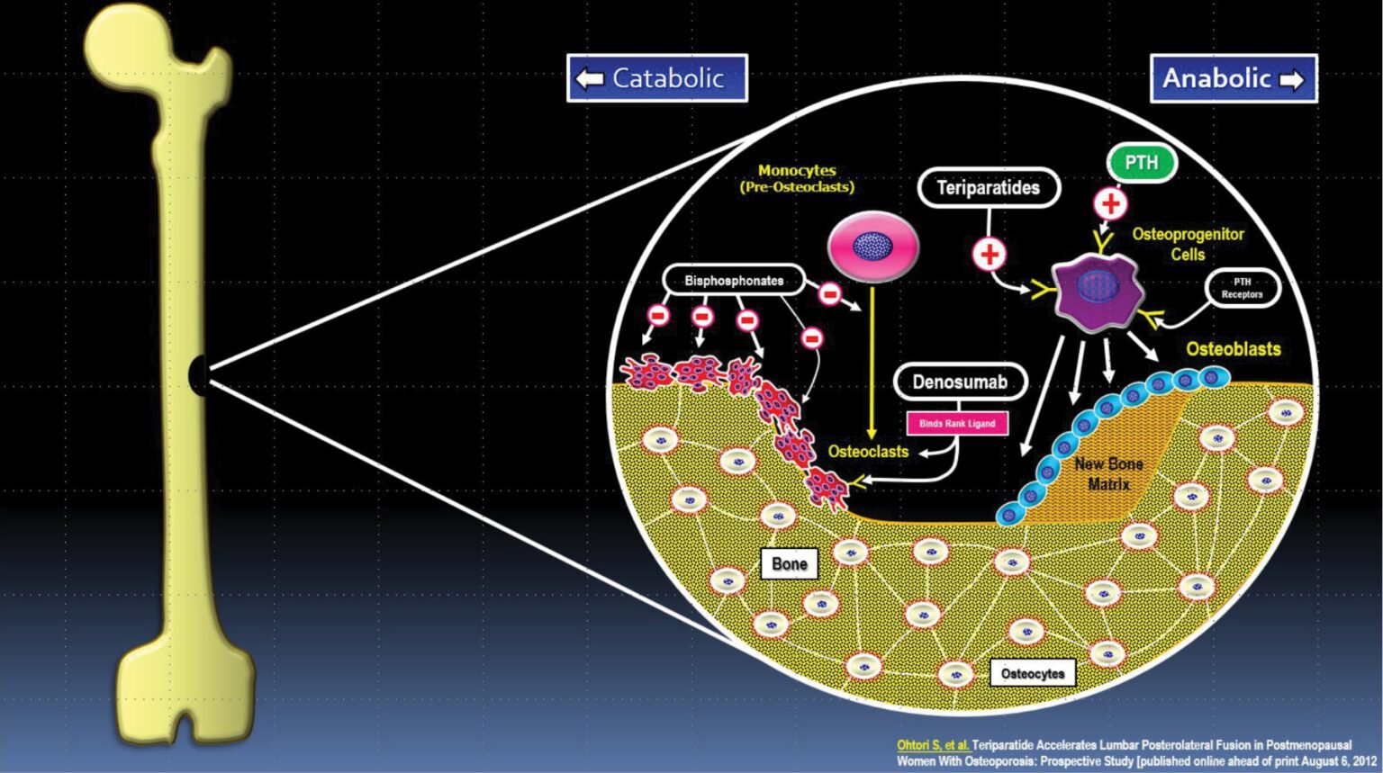 Your Osteoporosis is Treatable | National Spine Health Foundation