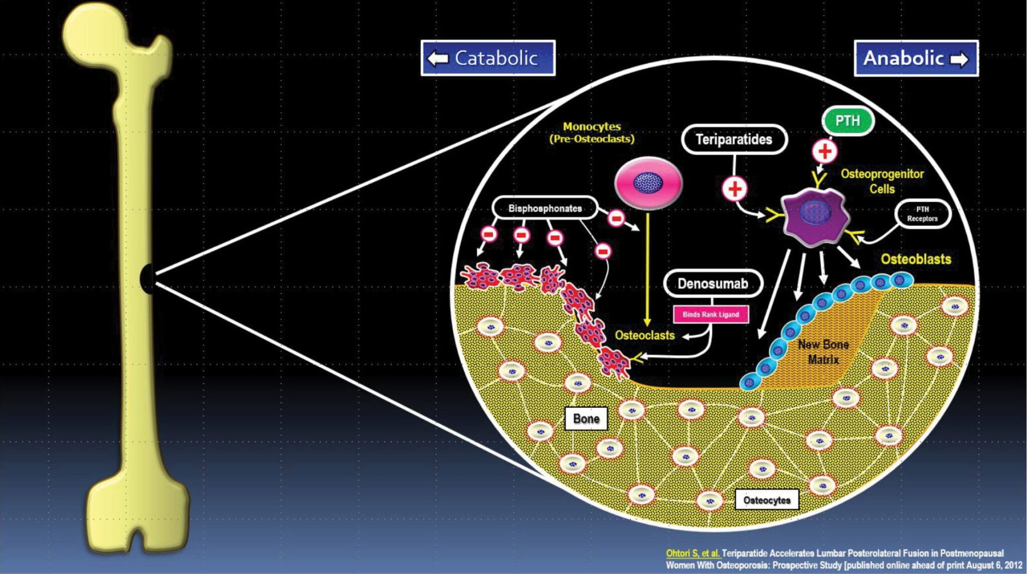 Your Osteoporosis is Treatable | National Spine Health Foundation