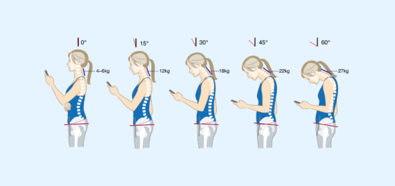 Backpacks and Back Pain in Children [Free Guide] | National Spine ...