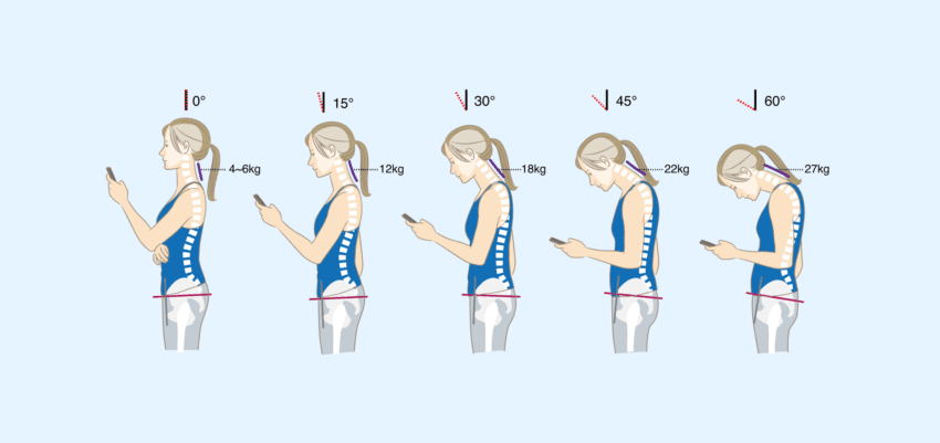 Backpacks and Back Pain in Children [Free Guide] | National Spine ...