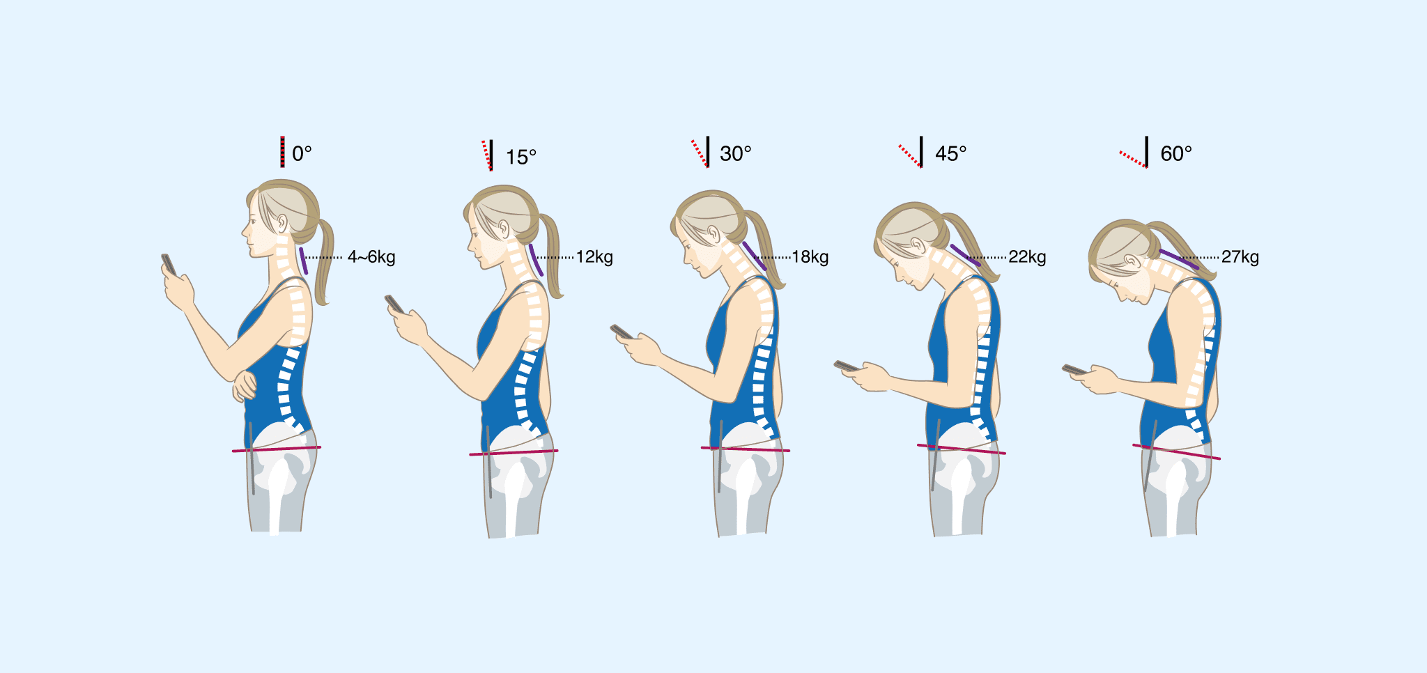 Backpacks and Back Pain in Children [Free Guide] | National Spine ...