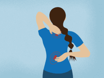 North American Spine Society: Patient Education | National Spine Health ...