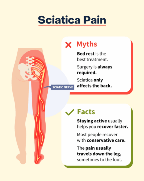 Sciatica: What You Need to Know About Causes, Treatments, and Prevention